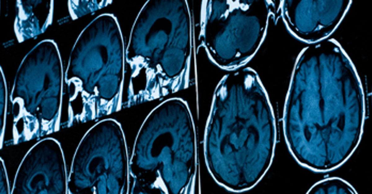 Deloitte Neuroscience Institute Introduction | Deloitte Deutschland